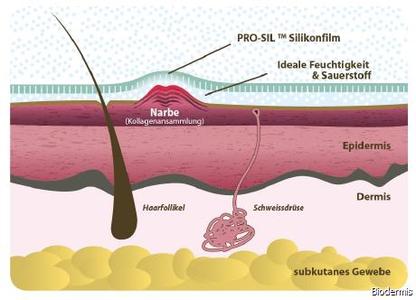 Effektive Narbenbehandlung - schnell, sicher & preiswert !, Dermamedix ...